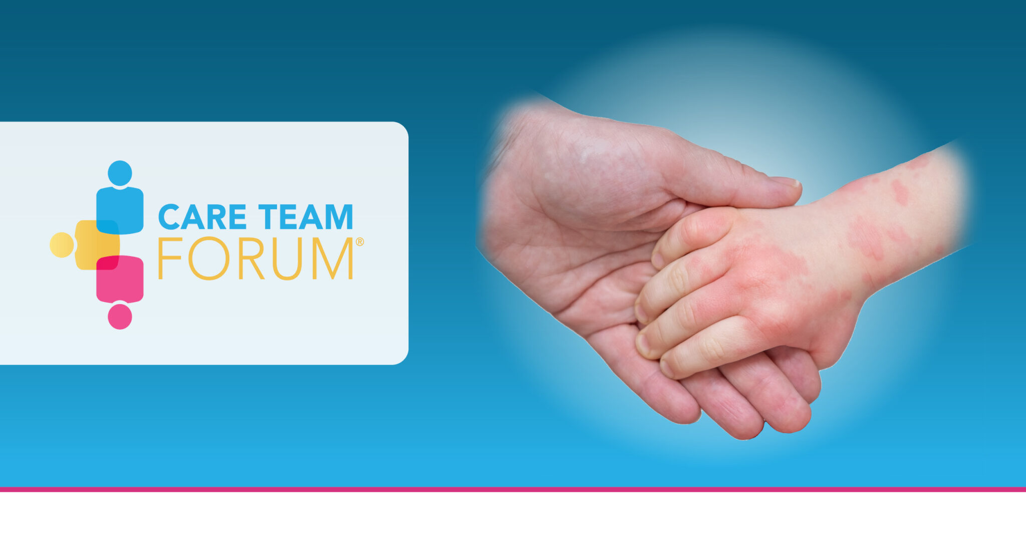 Optimizing Biologic Therapy in Children with Moderate-to-Severe Atopic ...